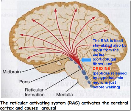 Damaged Reticular Activating System - loadingmod